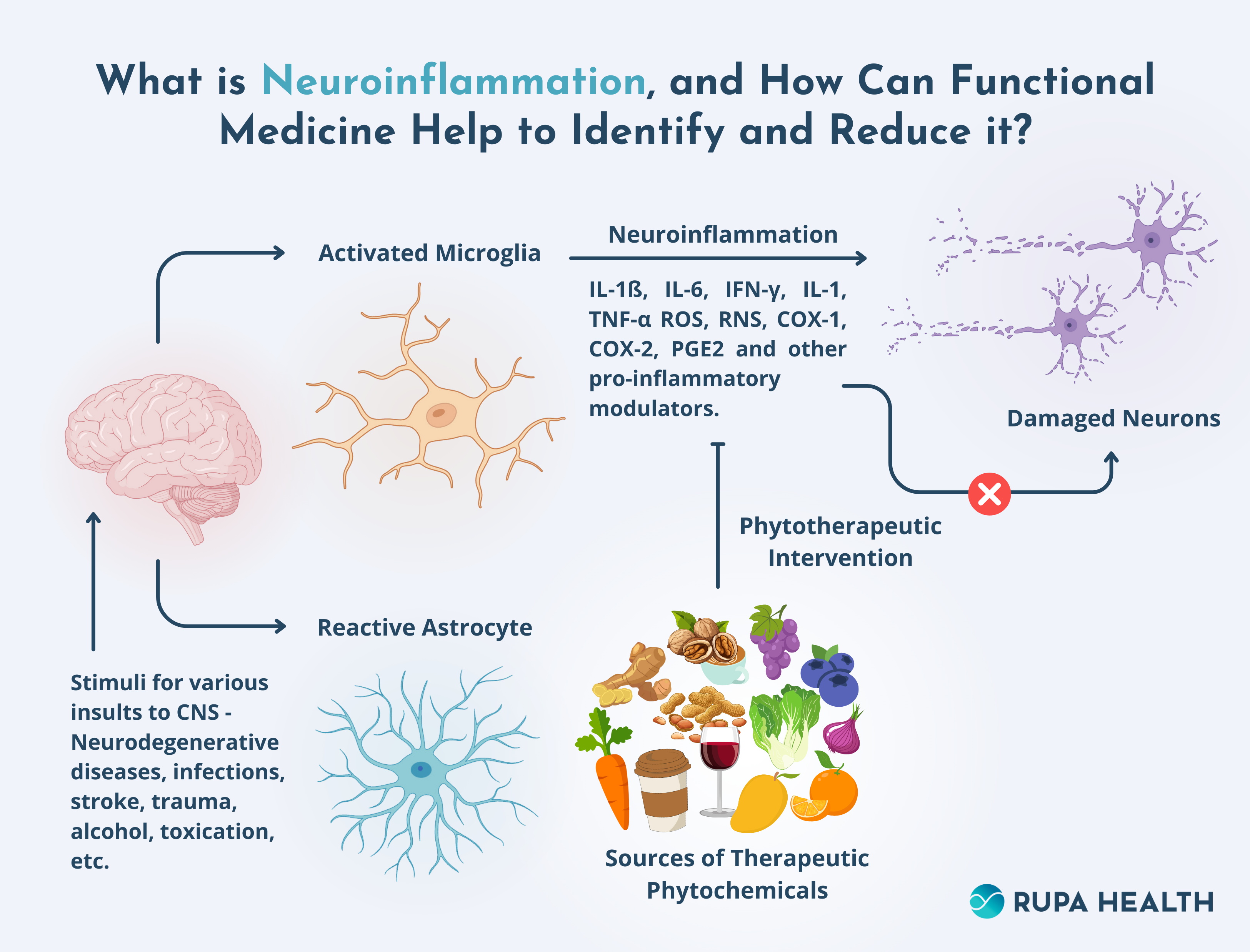 What is Neuroinflammation, and How Can Functional Medicine Help to Identify and Reduce it?